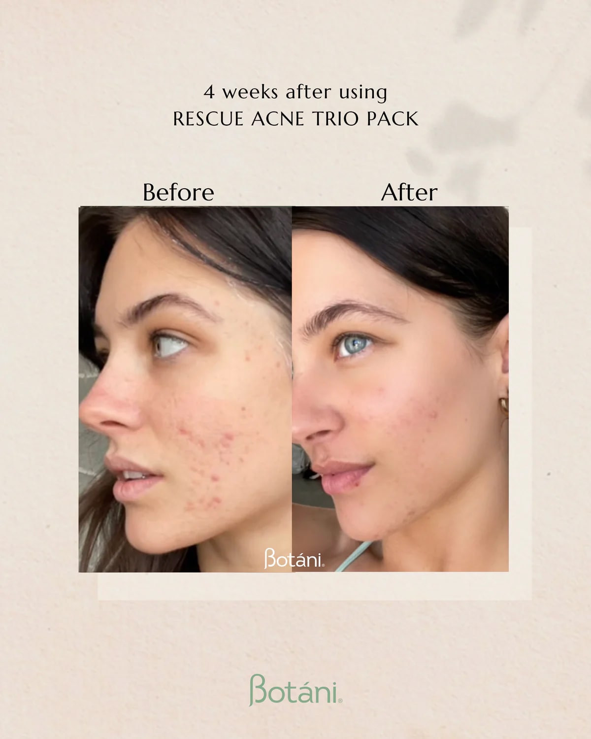 Natural Skincare Australia | Certified Vegan Products by Botani