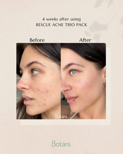 Natural Skincare Australia | Certified Vegan Products by Botani