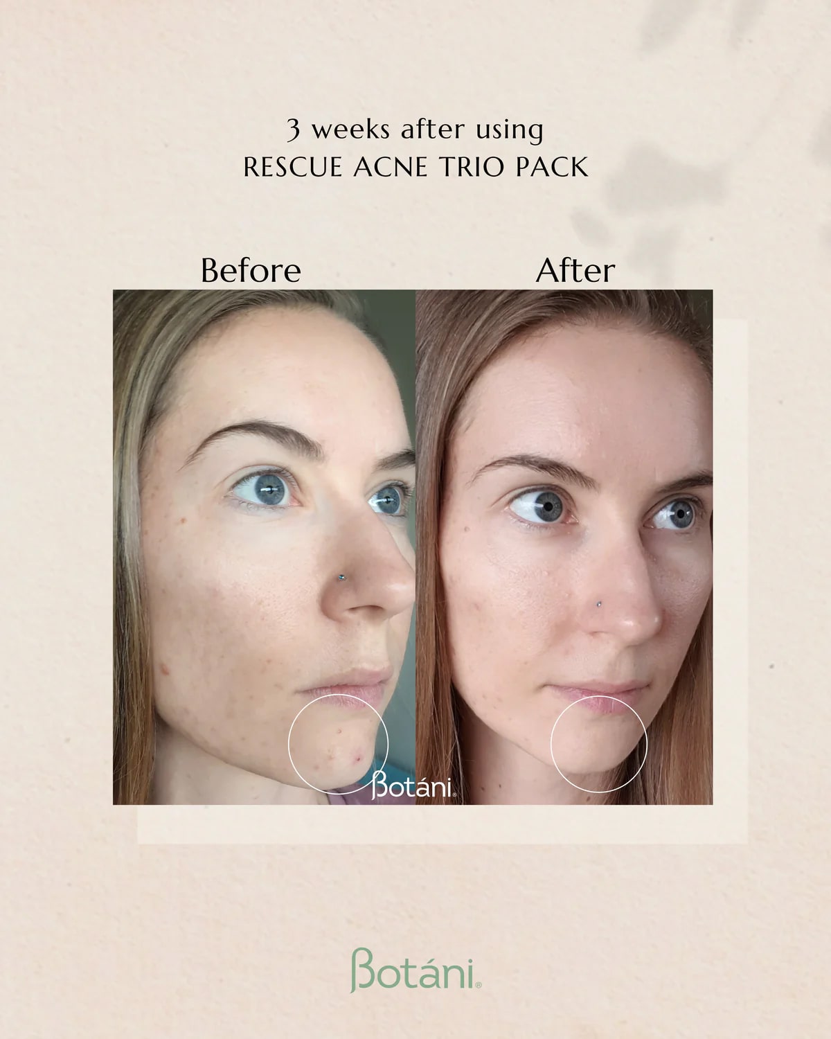 Natural Skincare Australia | Certified Vegan Products by Botani