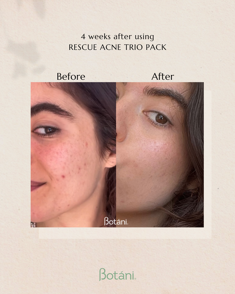 Natural Skin Care Products Australia | Buy Natural Skincare | Botani